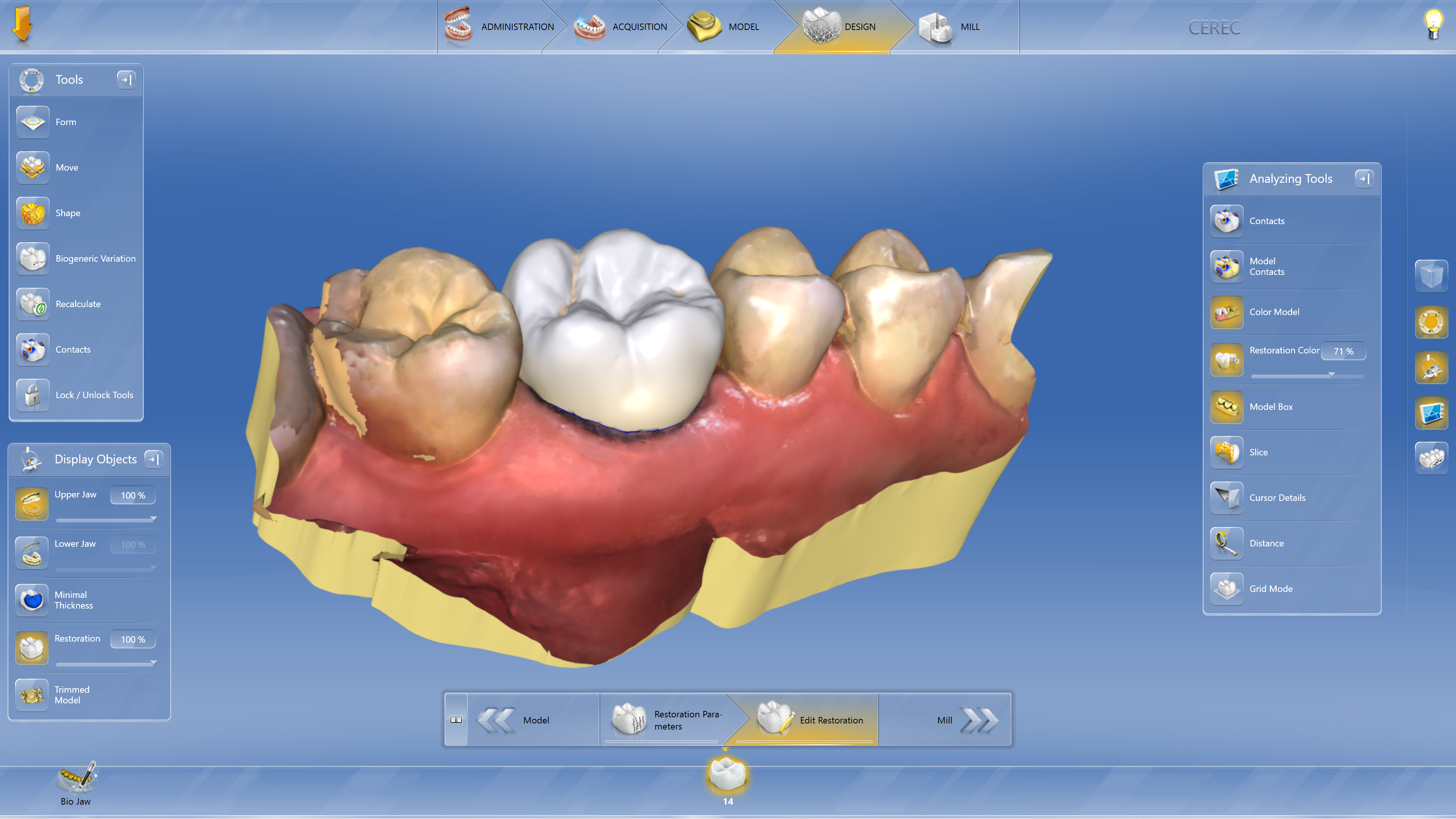 CEREC SW 4.5: Intuitive work using intelligent software to achieve ...