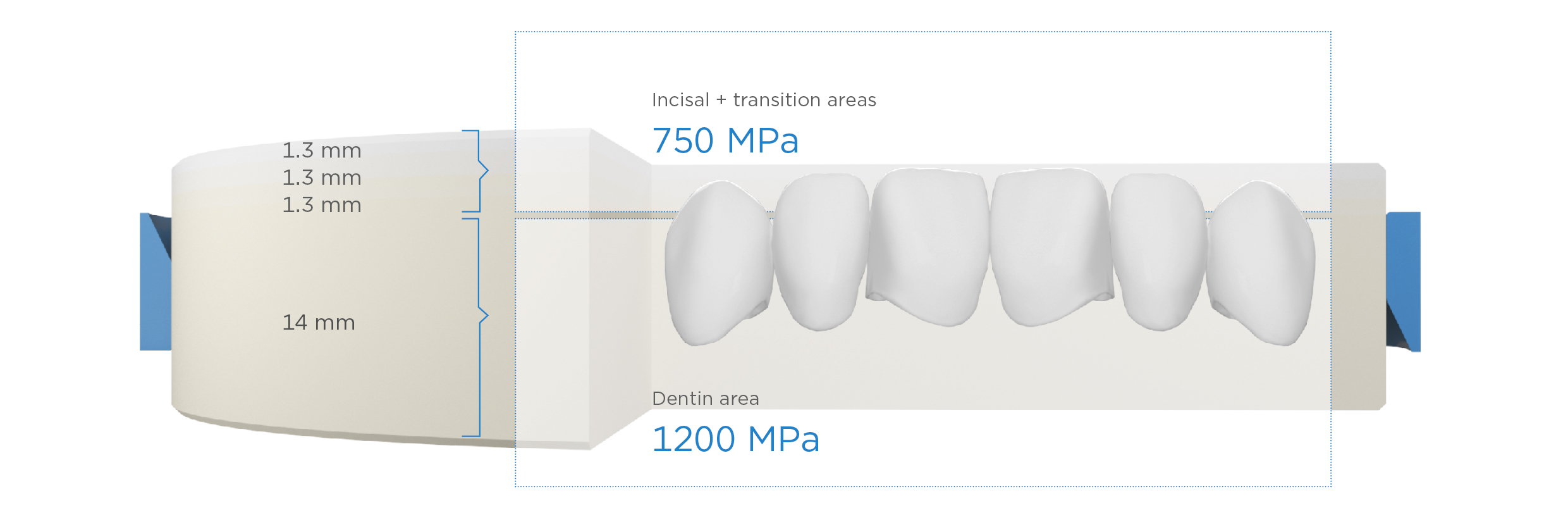 Cercon ht ML – fino a 14 elementi con la soluzione multistrato Cercon ...